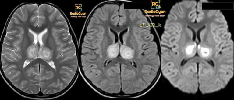 Aunt Minnie Radiology Cases | Spotters Set 47 | RadioGyan.com - RadioGyan