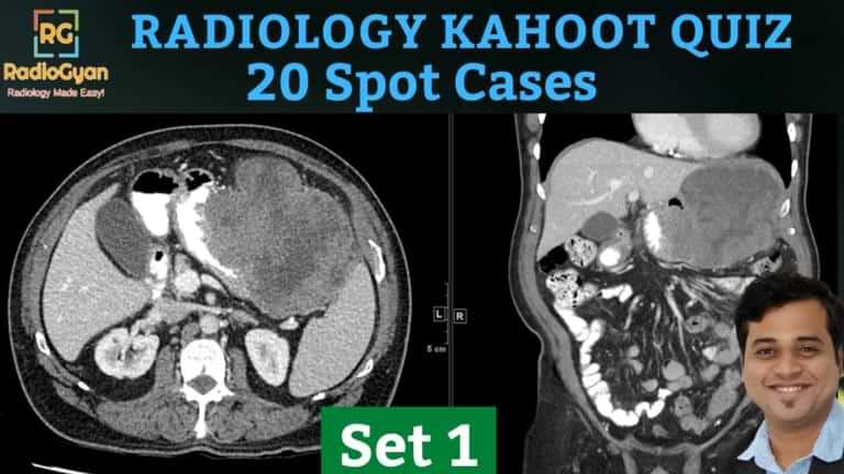 Radiology Quiz Kahoot | 20 Radiology Cases - RadioGyan