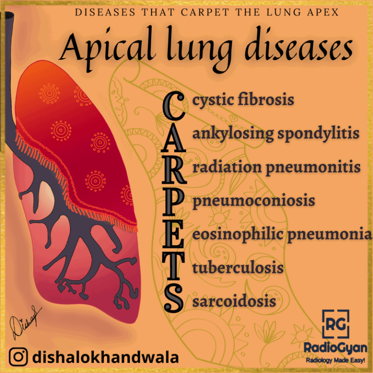 Causes of Apical Lung Diseases - Visual Mnemonics