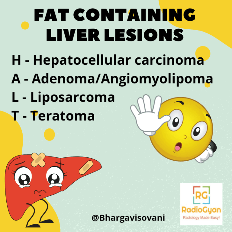 Fat Containing Liver Lesions - Visual Mnemonics