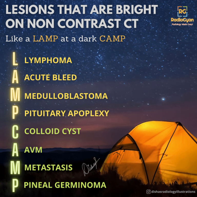 Radiology Mnemonics (Illustrated)
