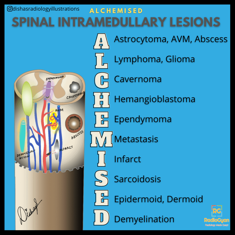 Intramedullary Lesions - Visual Mnemonics - RadioGyan