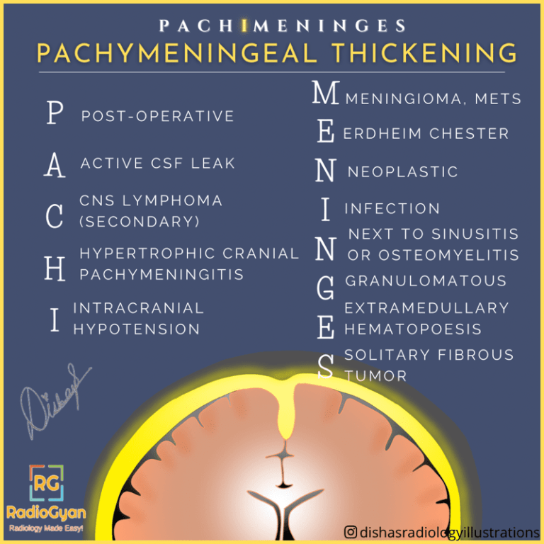 Radiology Mnemonics (Illustrated)
