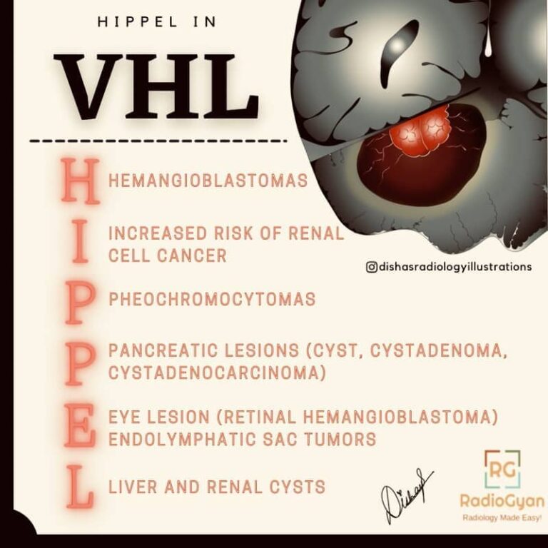 Radiology Mnemonics (Illustrated)