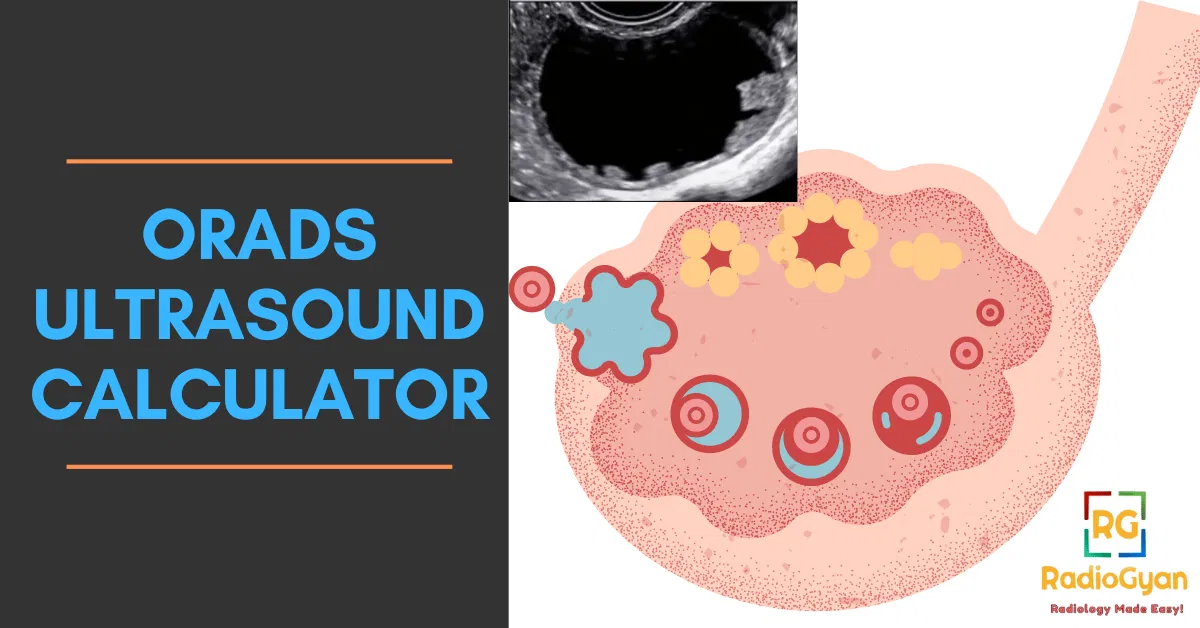 O-RADS Ultrasound Calculator - ACR Guidelines - RadioGyan