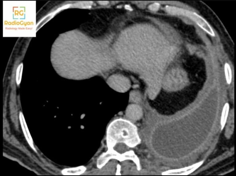 Radiology Signs