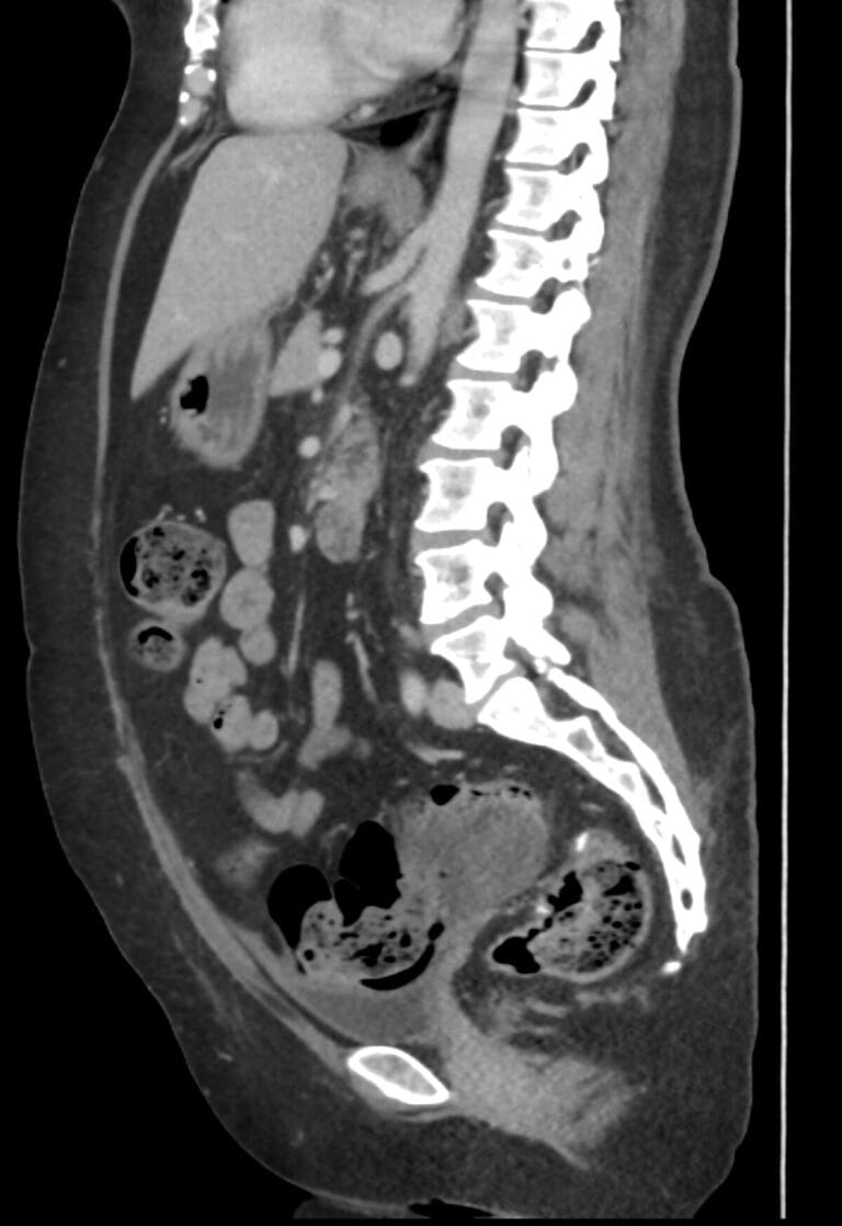 Etymology of Imaging Planes - Axial, Sagittal and Coronal