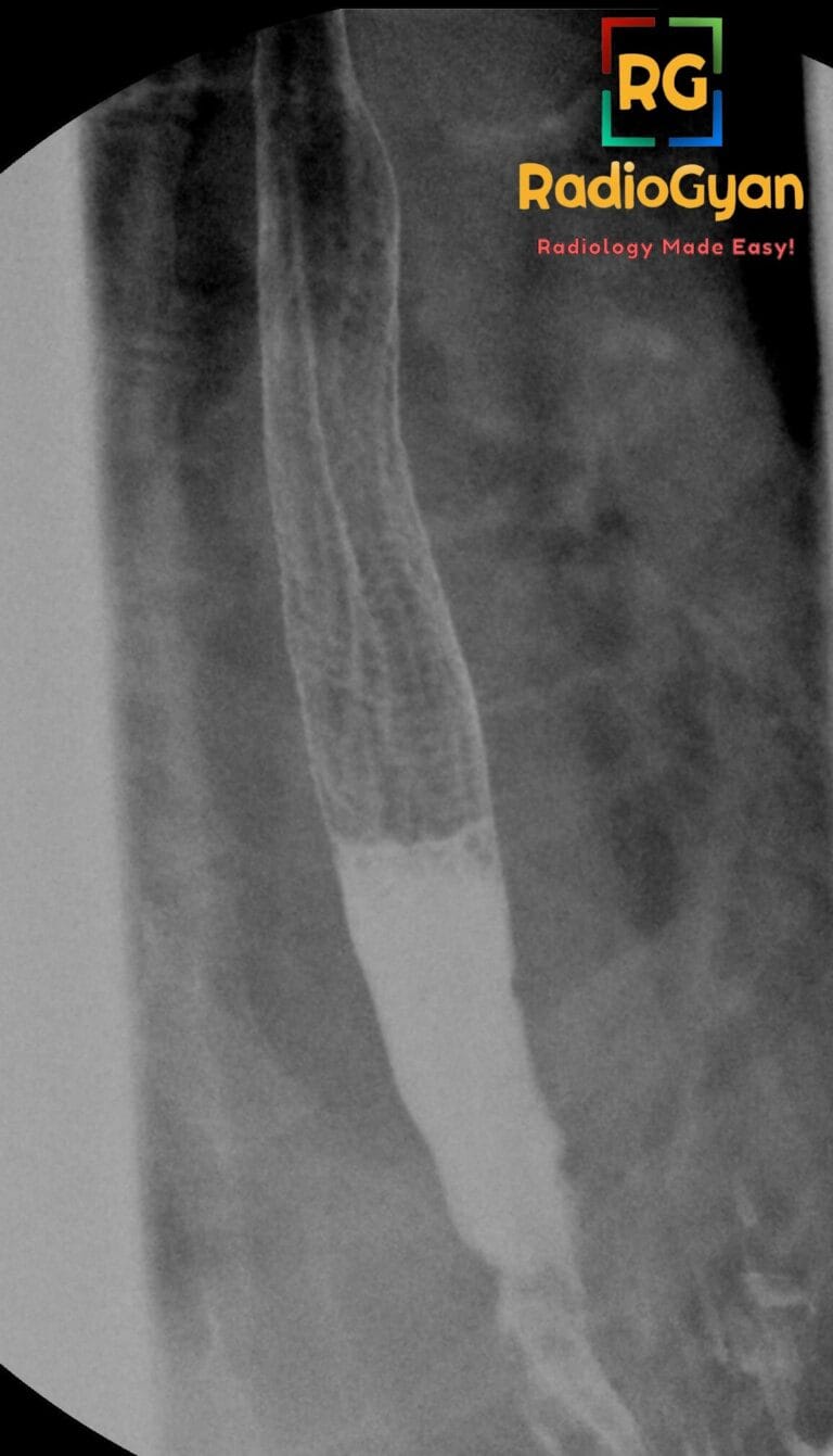 Feline esophagus | Radiology Signs