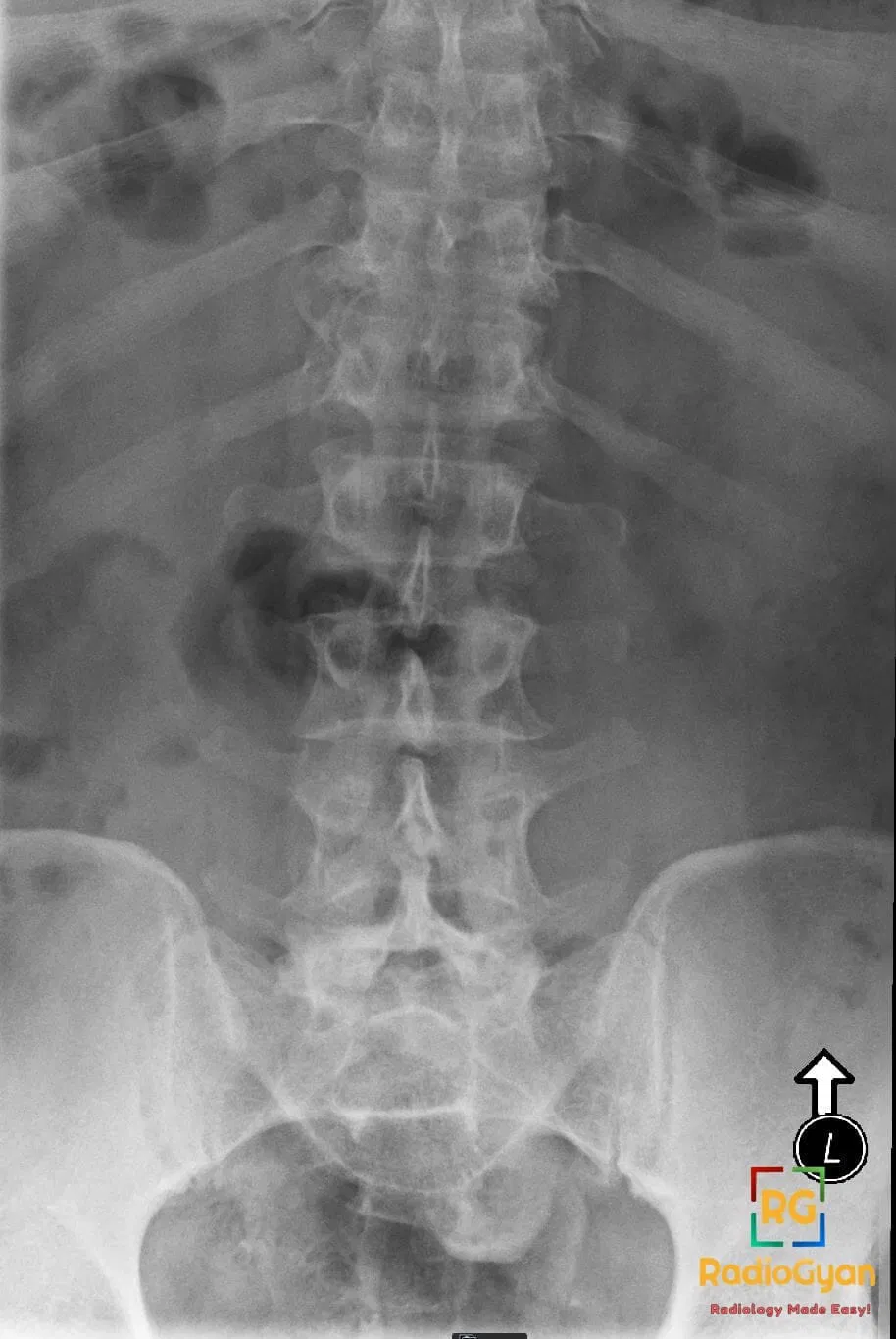 Radiology Case of the Day 98