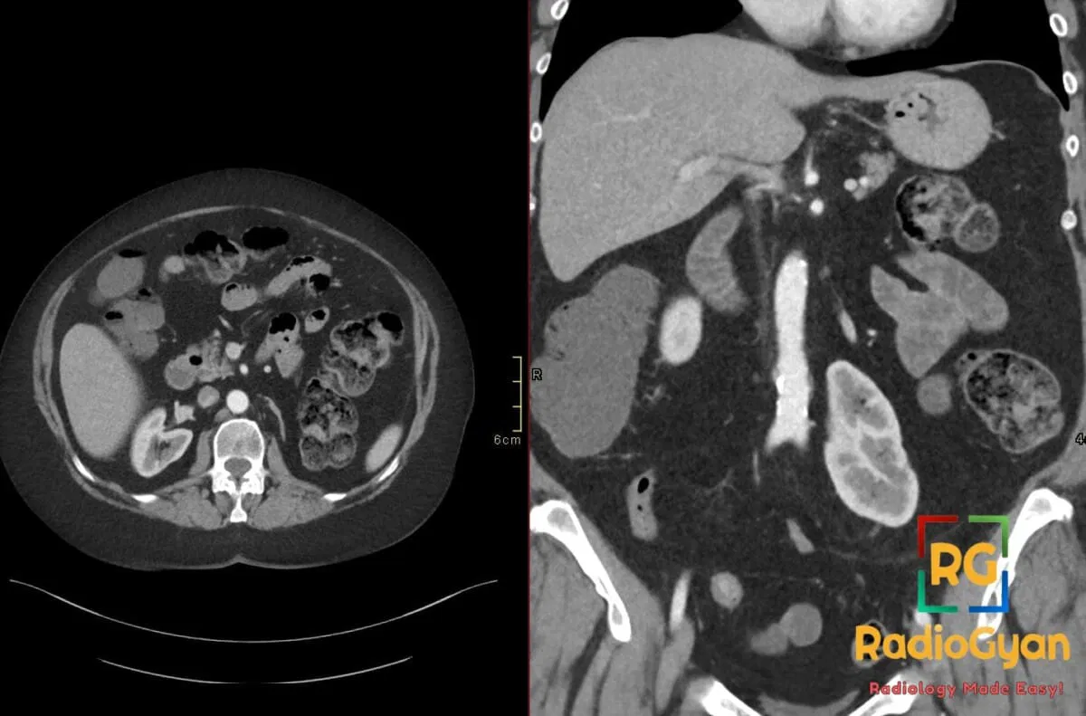 Radiology Case of the Day 99
