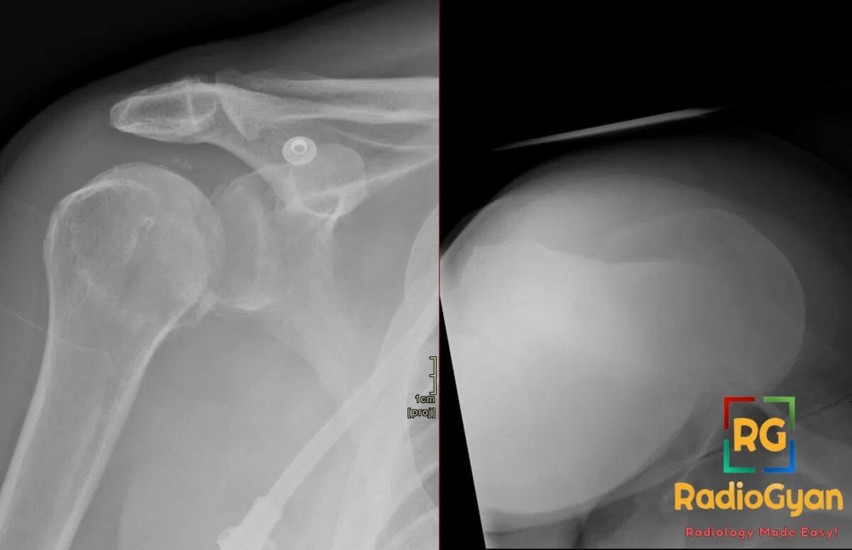 Radiology Case of the Day 97