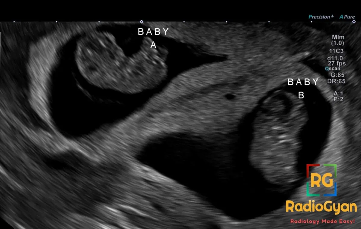 Radiology Case of the Day 100